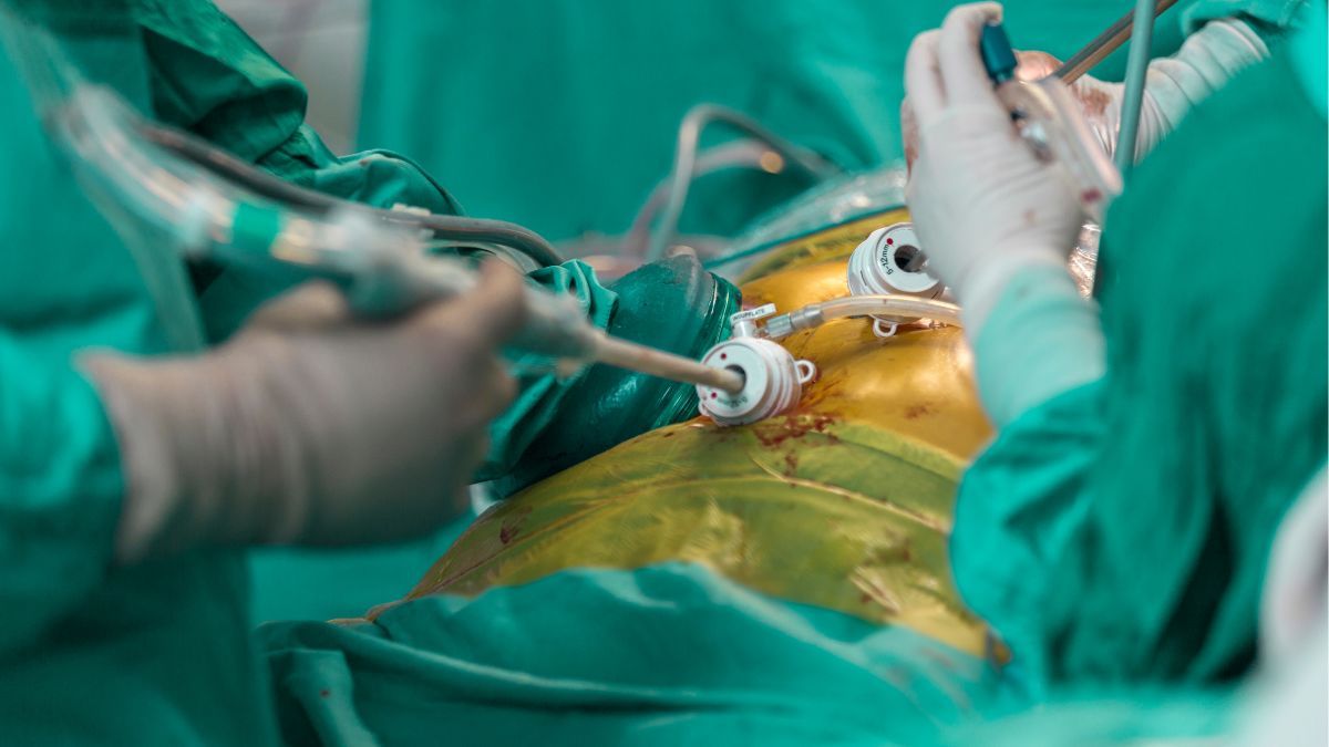 7 Jenis Operasi Miom pada Wanita - KlikDokter